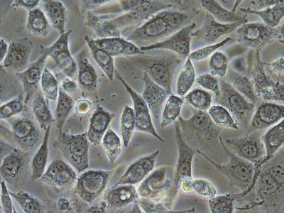 Diverse strains of Chlamydia found in student area of Southampton ...