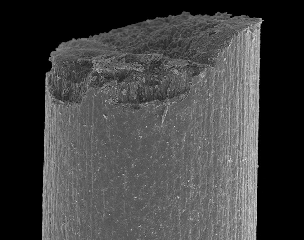 SEM Image Gallery | Biomedical Imaging Unit | University of Southampton