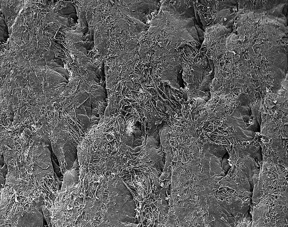 SEM Image Gallery | Biomedical Imaging Unit | University of Southampton