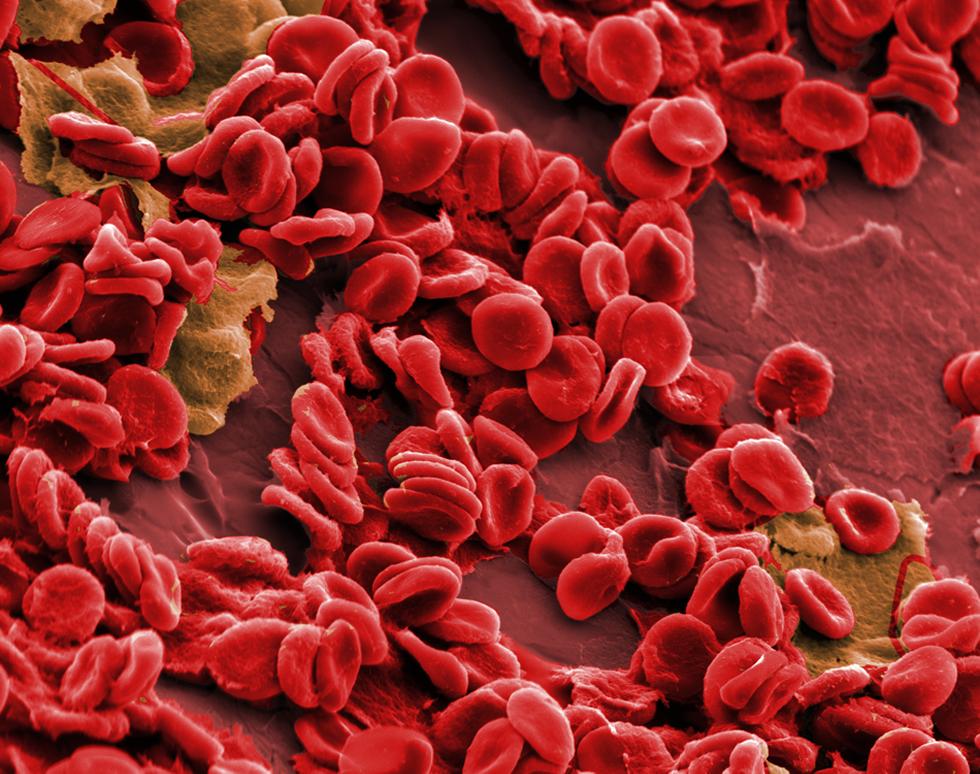 SEM Image Gallery | Biomedical Imaging Unit | University of Southampton