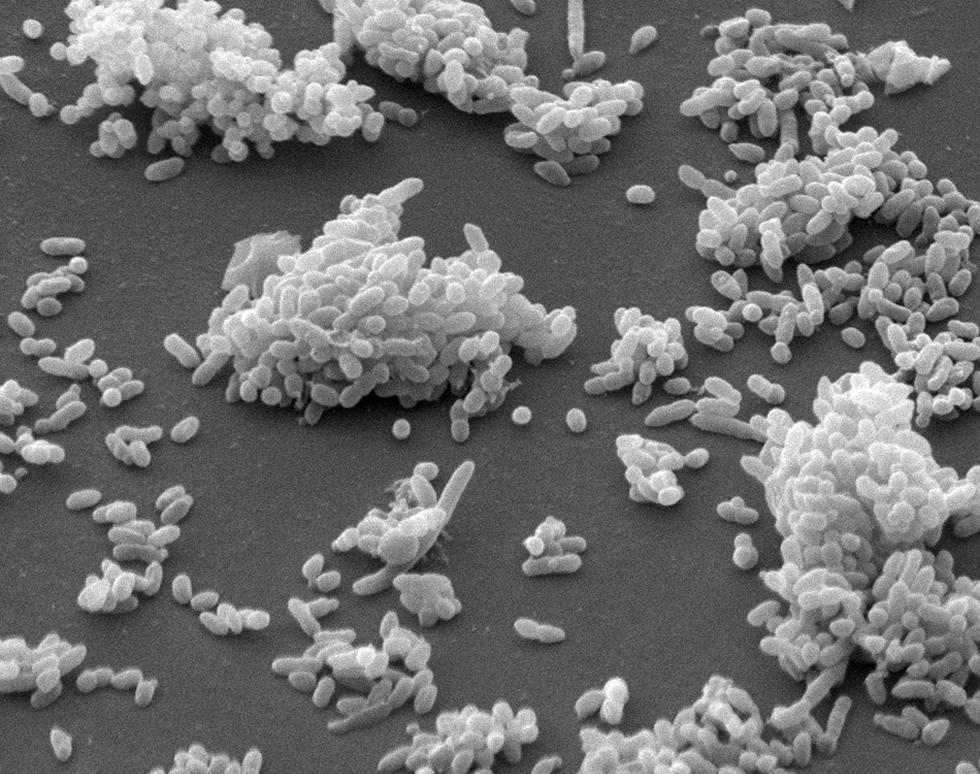 SEM Image Gallery | Biomedical Imaging Unit | University of Southampton