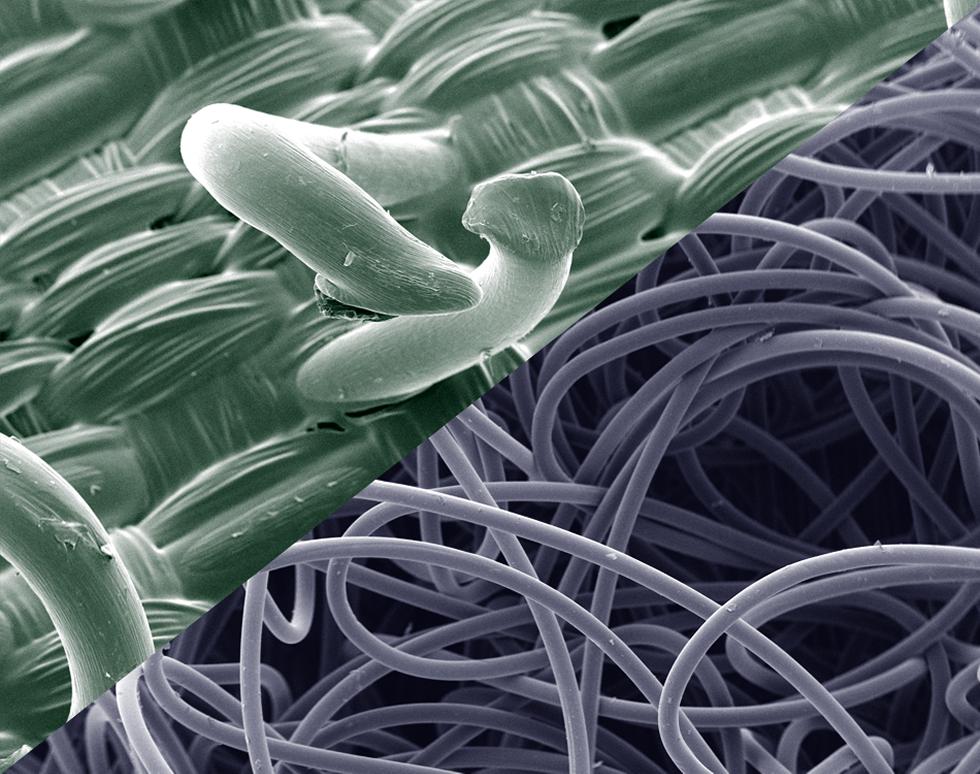 SEM Image Gallery | Biomedical Imaging Unit | University of Southampton