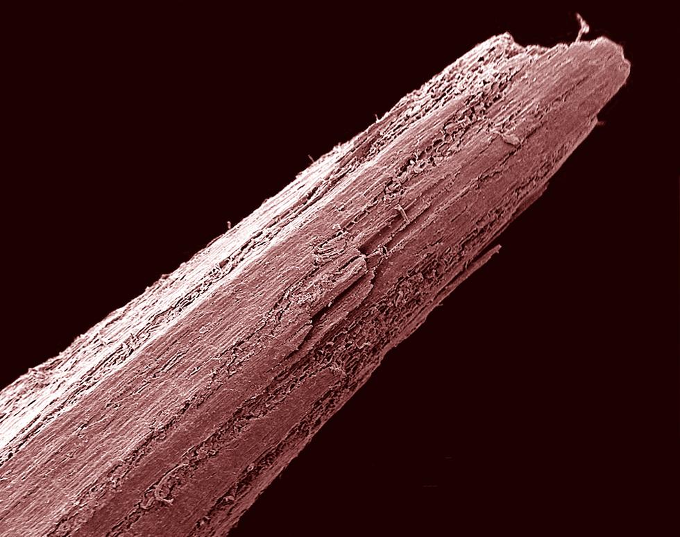 SEM Image Gallery | Biomedical Imaging Unit | University of Southampton