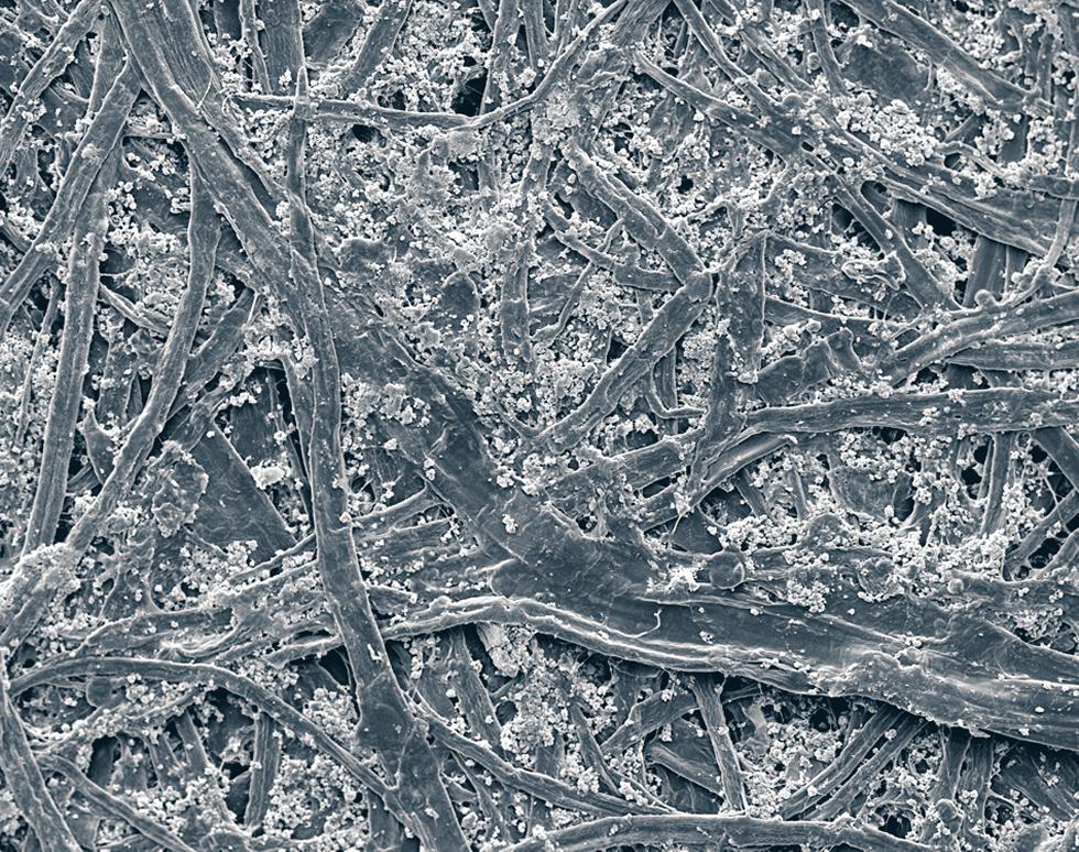 SEM Image Gallery | Biomedical Imaging Unit | University of Southampton