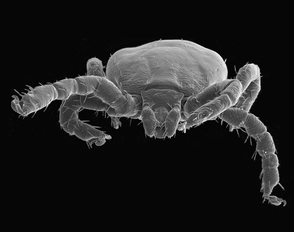 SEM Image Gallery | Biomedical Imaging Unit | University of Southampton