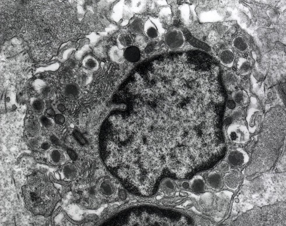 TEM Image Gallery | Biomedical Imaging Unit | University of Southampton