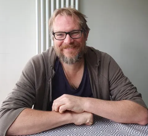 Mobility Limiting Lower Limb Conditions in Nepal: Scale, treatment and ...